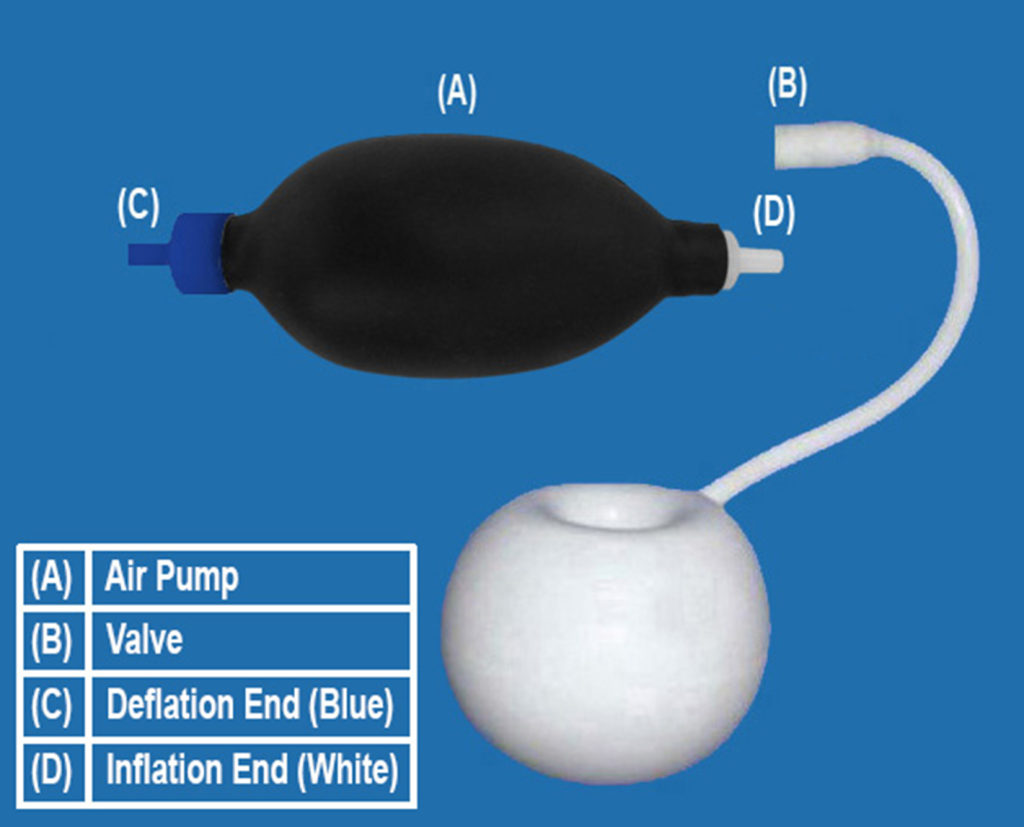 Inflatable Pessary 2.75" - Artisan Medical